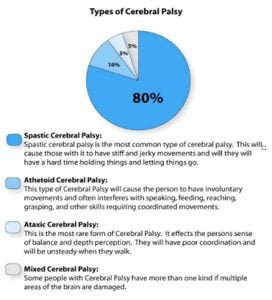 Guillain-Barré Syndrome (GBS) Rehabilitation and Support | Doveston Health